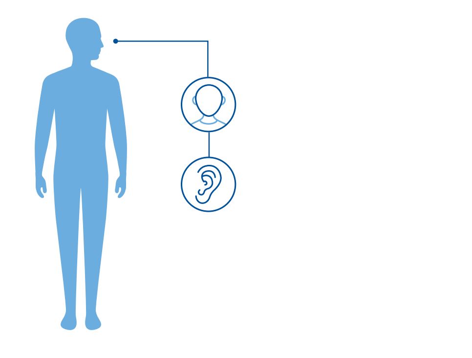 Mandibulofacial dysostose-mikrokefali (MFDM) - Oslo universitetssykehus HF