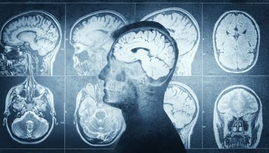 Hjerneslag, behandling - Oslo universitetssykehus HF