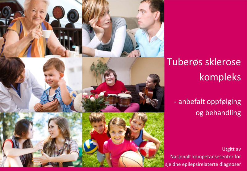 Tuberøs sklerose - Oslo universitetssykehus HF